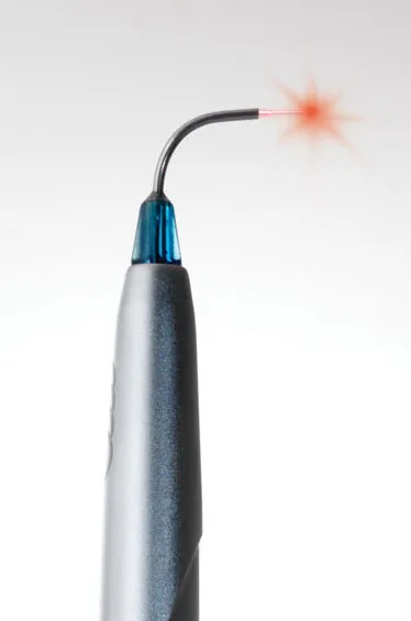 Periodontal Laser Therapy for Gum Disease Rochester | Med City Dental